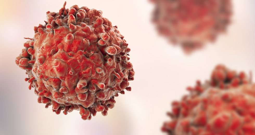 Recurrent Cancer: Why Is It Coming Back After Treatment? - Health Highroad