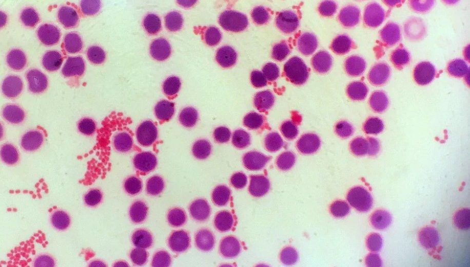 Study Finally Learns More About Sepsis and How it Causes Cell Death ...